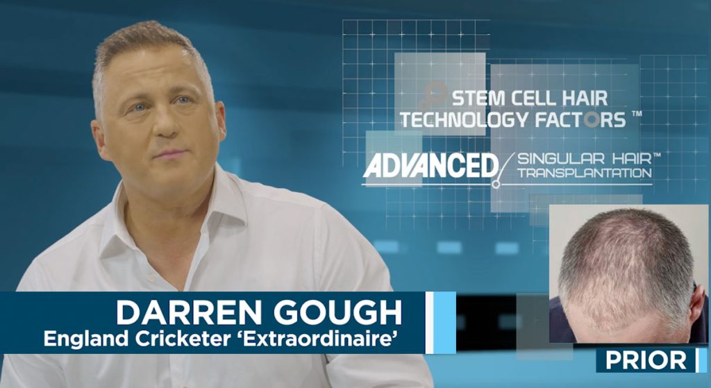 Advanced Singular Hair Transplantation™ - Advanced Hair Studio