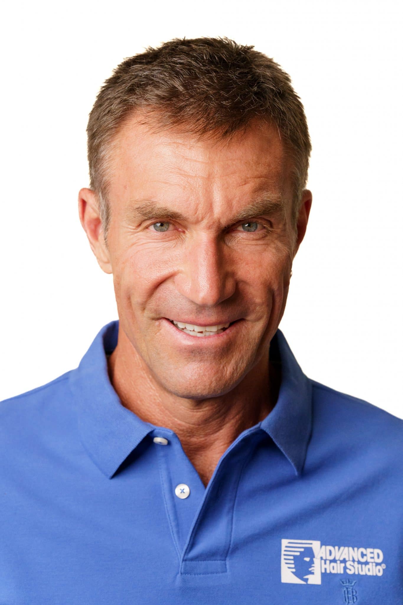 Male Hair Loss Treatment - Client Before & After Pictures